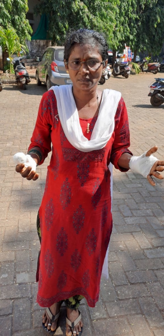 The Goan EveryDay: Woman injured in wild boar attack at Poinguinim